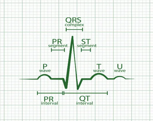 1. Basic Electrocardiography (ECG) - NurPass